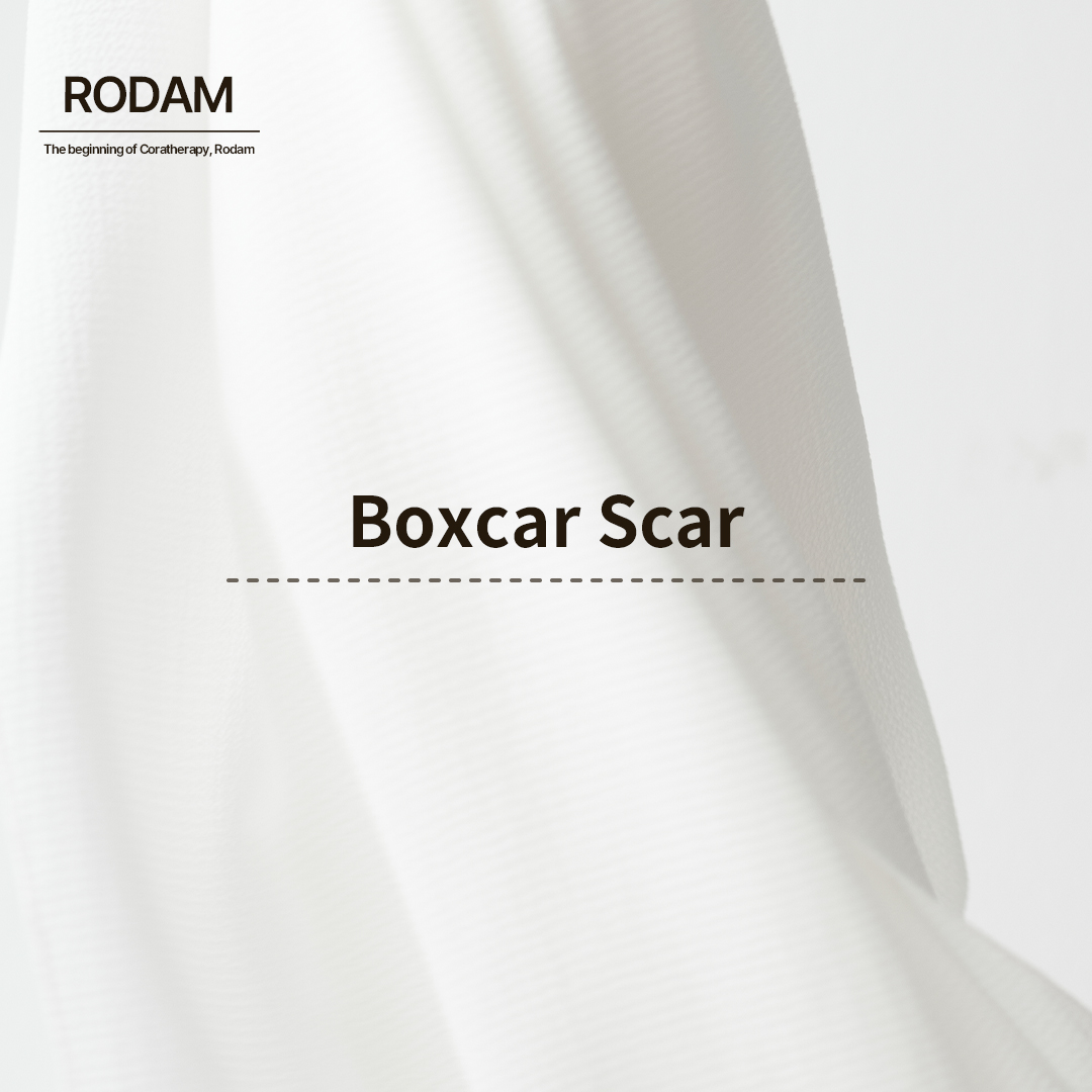 All About Boxcar Acne Scars Treatment at Rodam Korean Medicine Clinic